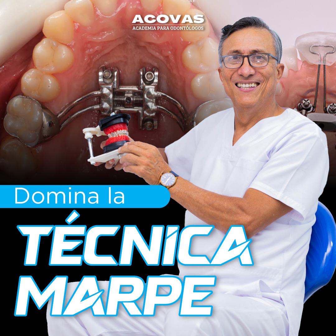 Domina la técnica MARPE - ACOVAS | Hotmart