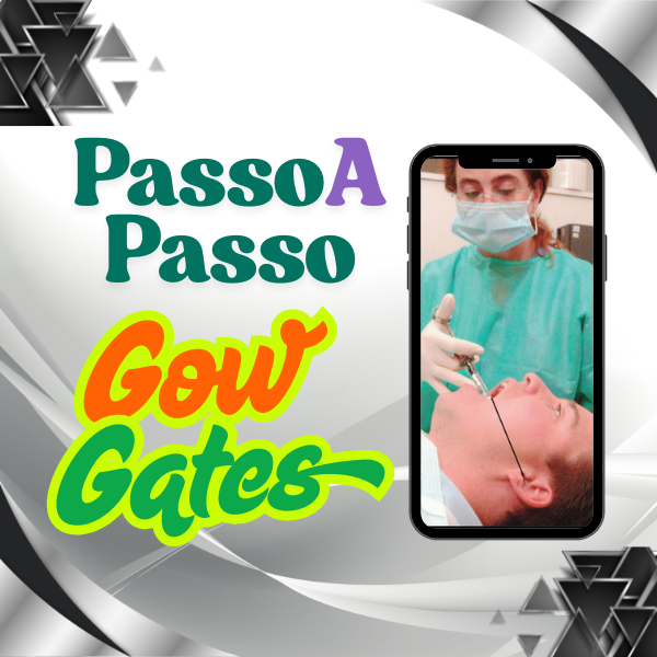 PDF - PASSO A PASSO da TÉCNICA Gow-Gates - Aula 107 - Odonto DH | H...