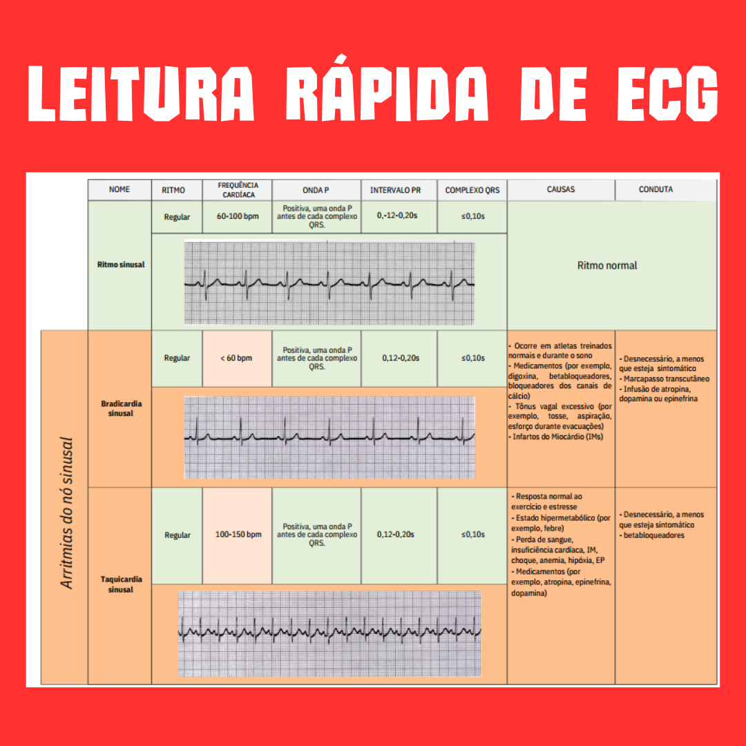 Leitura Normal De Ecg Eletrocardiograma Do Zero: Guia Para Iniciantes