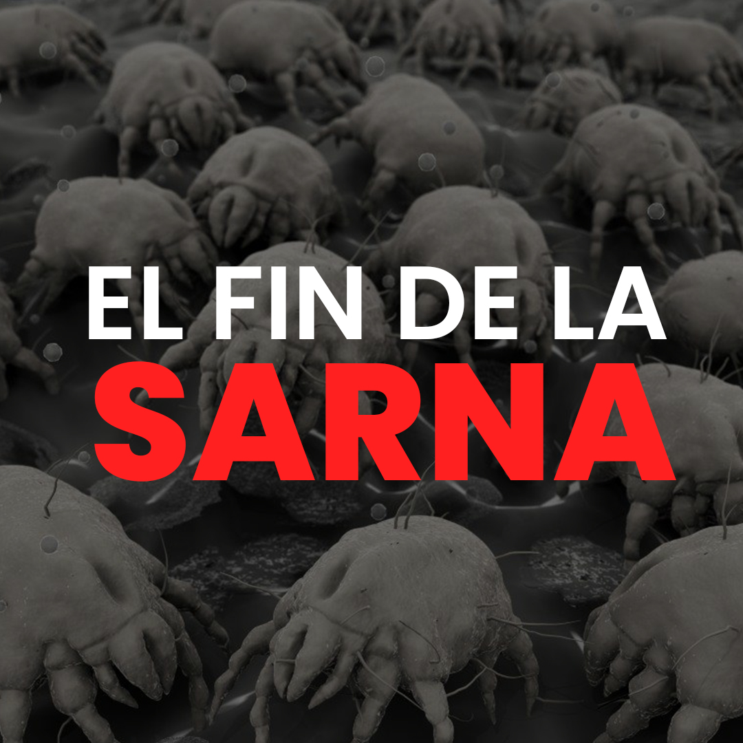 El fin de la sarna - Rafael de Oliveira Freitas | Hotmart