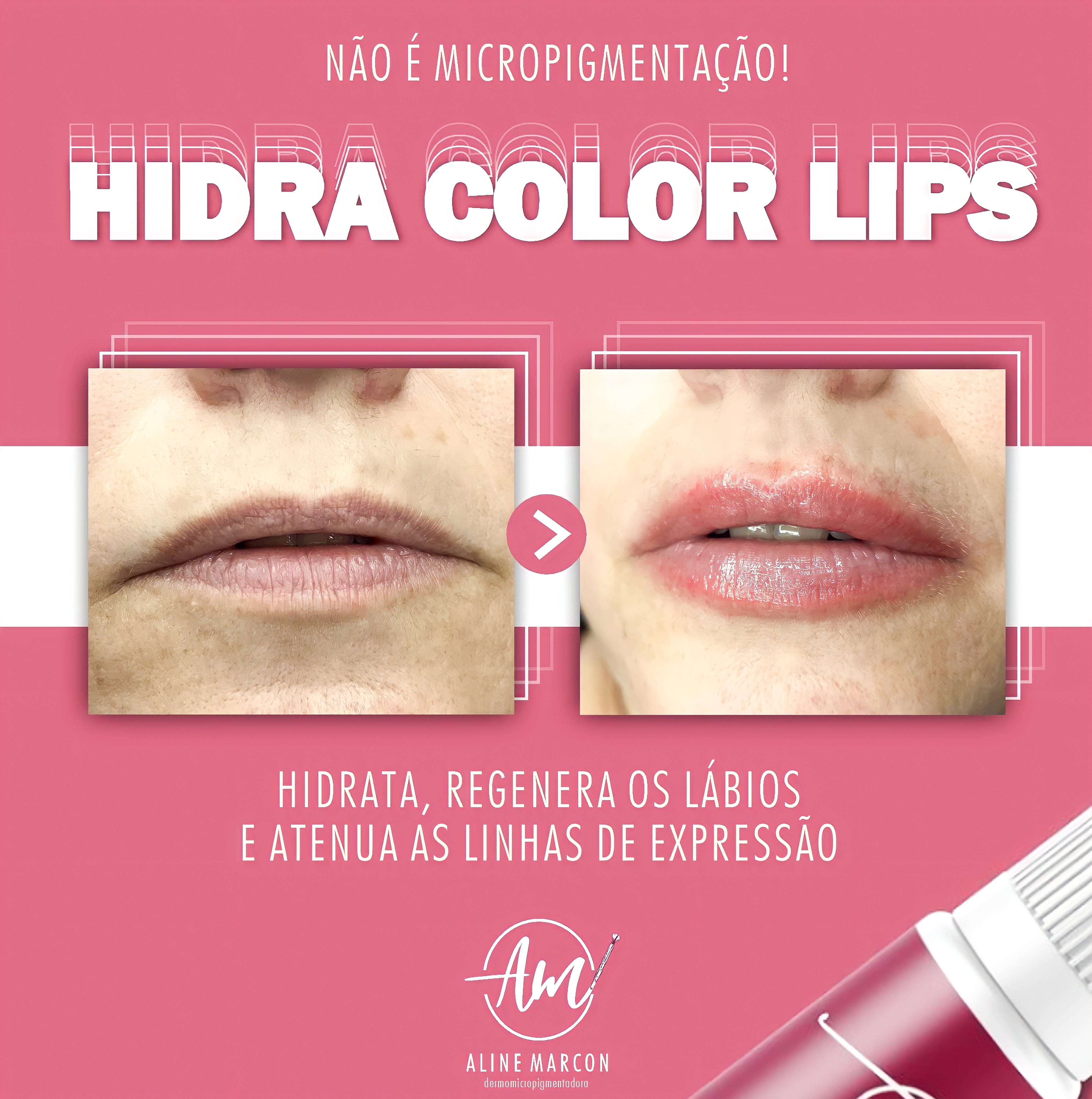 Hidra Color Lips