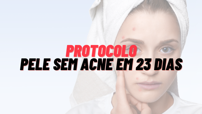 Protocolo Pele Sem Acne Em 23 Dias - Layane Isabela de Souza da Sil...